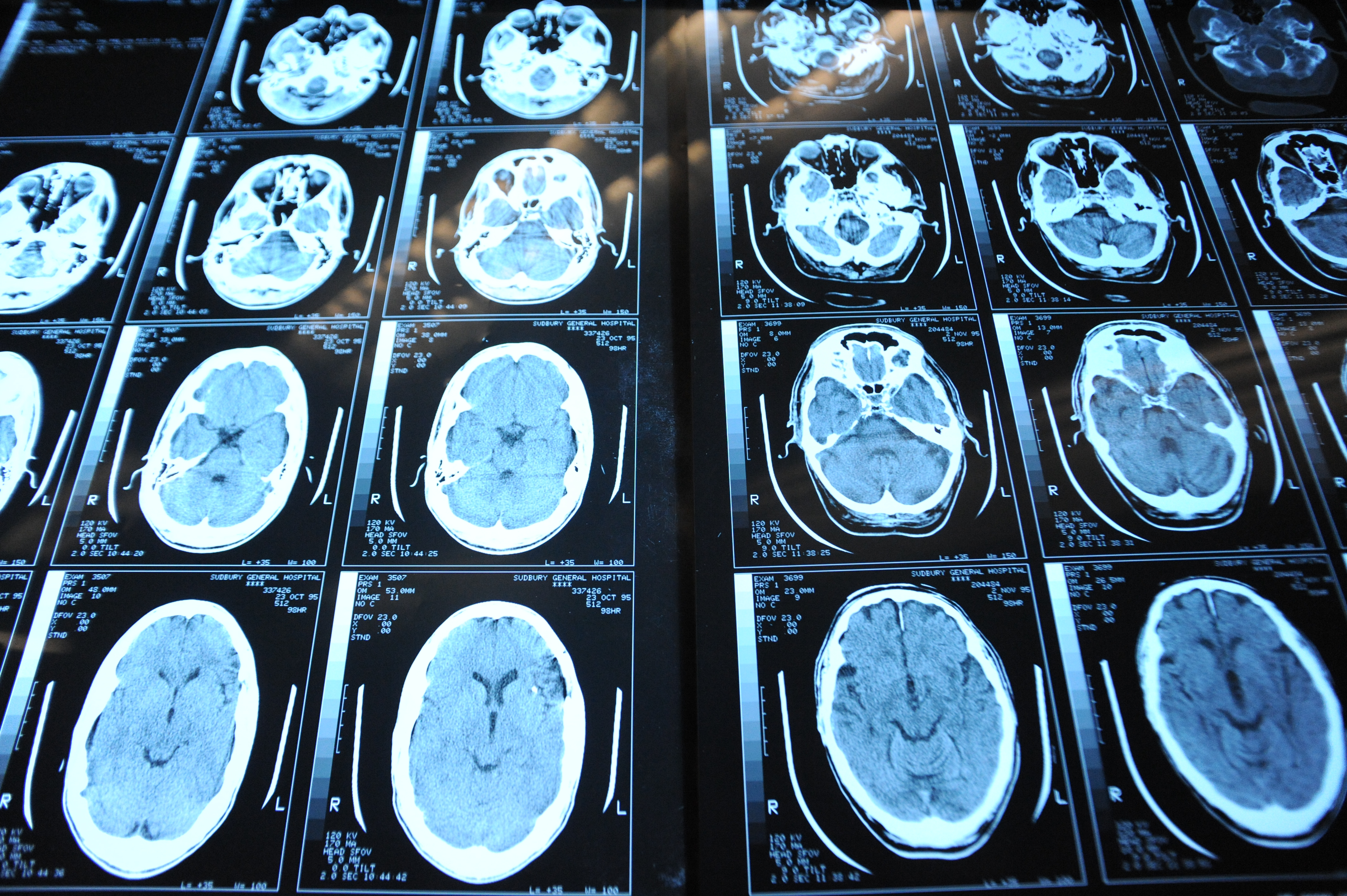 Behavioural Neuroscience | Laurentian University